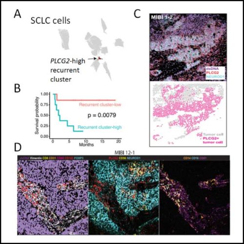 Small, High PLCG2-Expressing Intratumoral Cells May Drive Metastasis ...